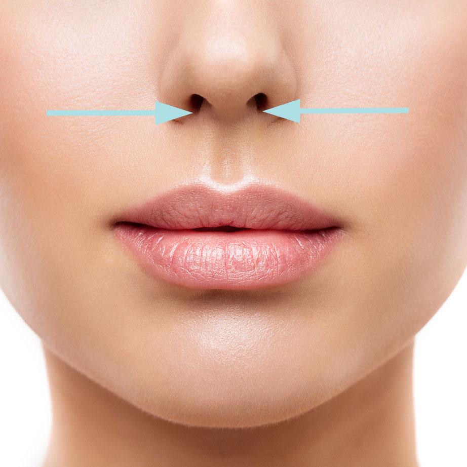 Lip Lift Toronto - Facial Surgeon - Cosmedical Rejuvenation Clinic